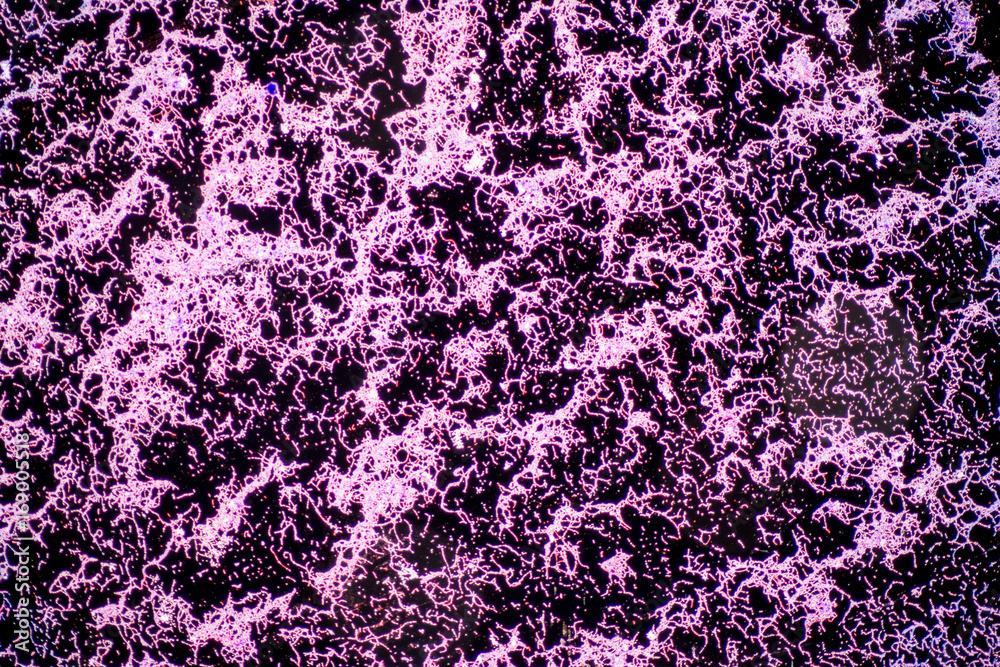 Bacillus is a genus of gram-positive, rod-shaped bacteria and a member ...