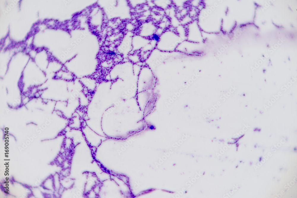 Bacillus is a genus of gram-positive, rod-shaped bacteria and a member ...