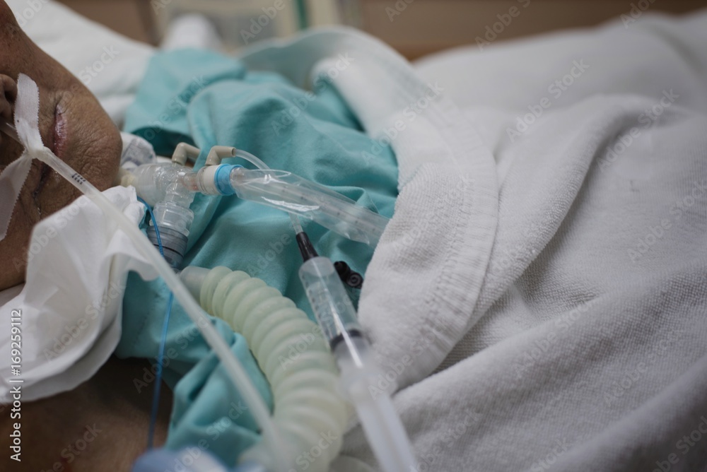 Patient do tracheostomy and ventilator in hospital Stock Photo | Adobe ...