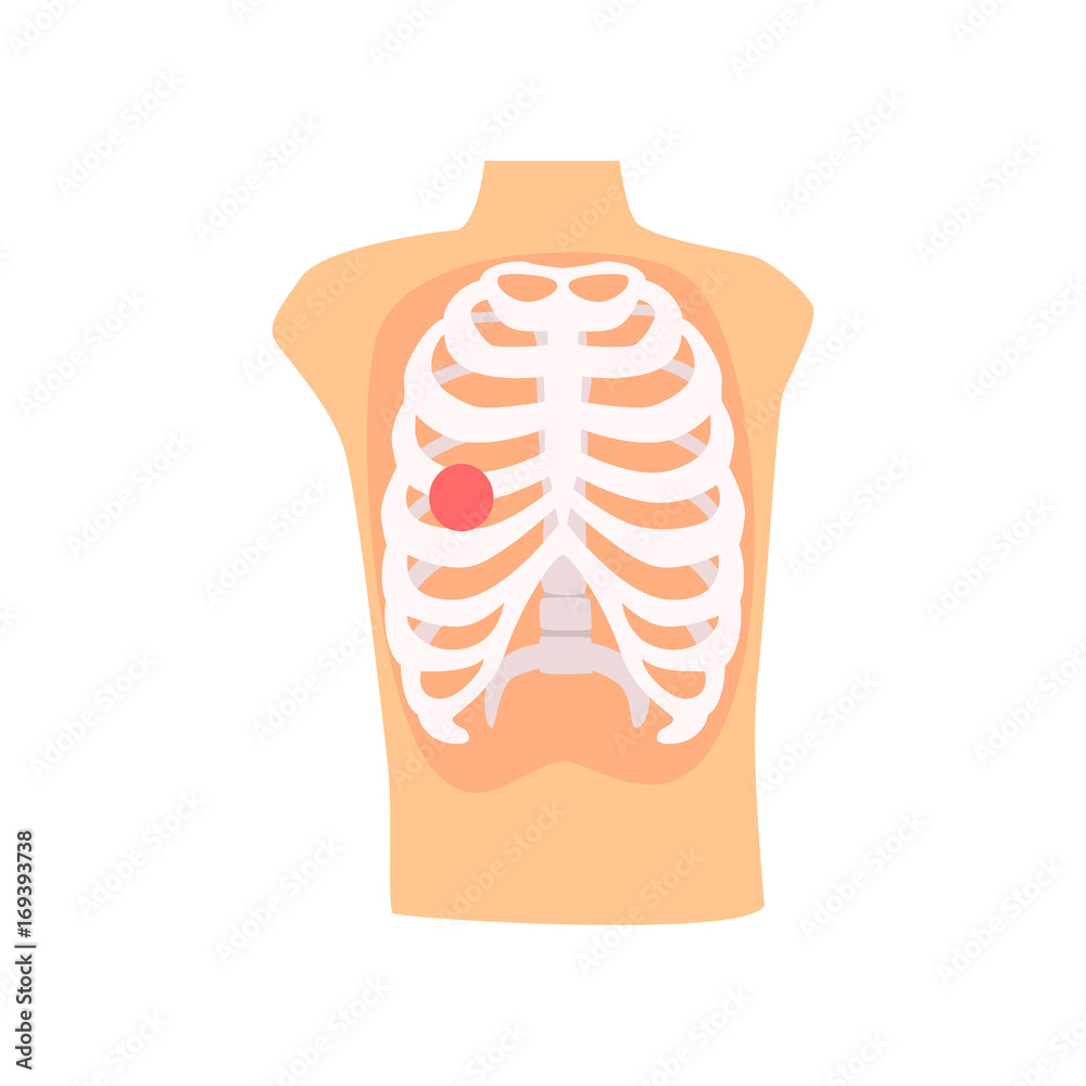 Rib injury pain cartoon vector Illustration Stock Vector | Adobe Stock