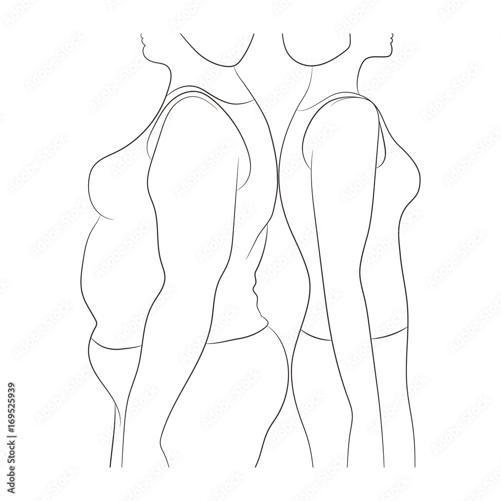 Female Arm Side View