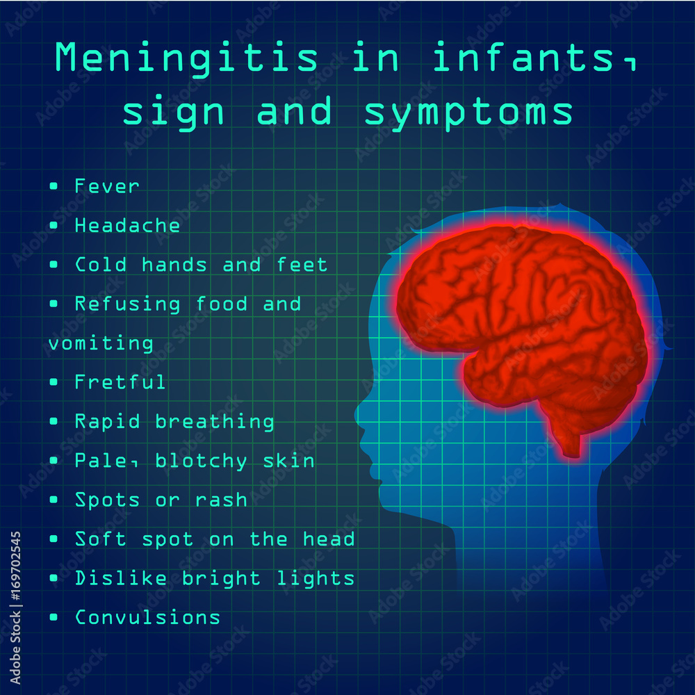 Meningitis in infants, signs and symptoms. Vector medical illustration ...