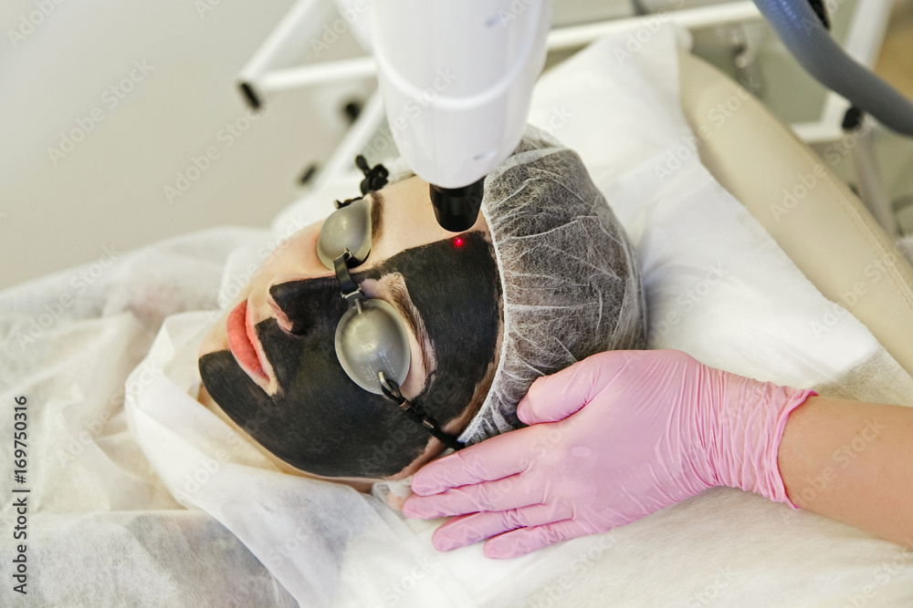 Procedure carbon peeling. Laser rejuvenation and skin lightening ...
