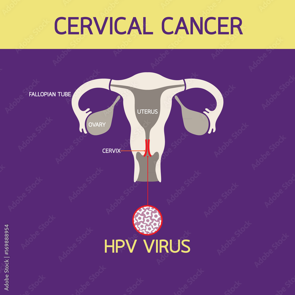cervical cancer icon Logo vector illustration Stock Vector | Adobe Stock