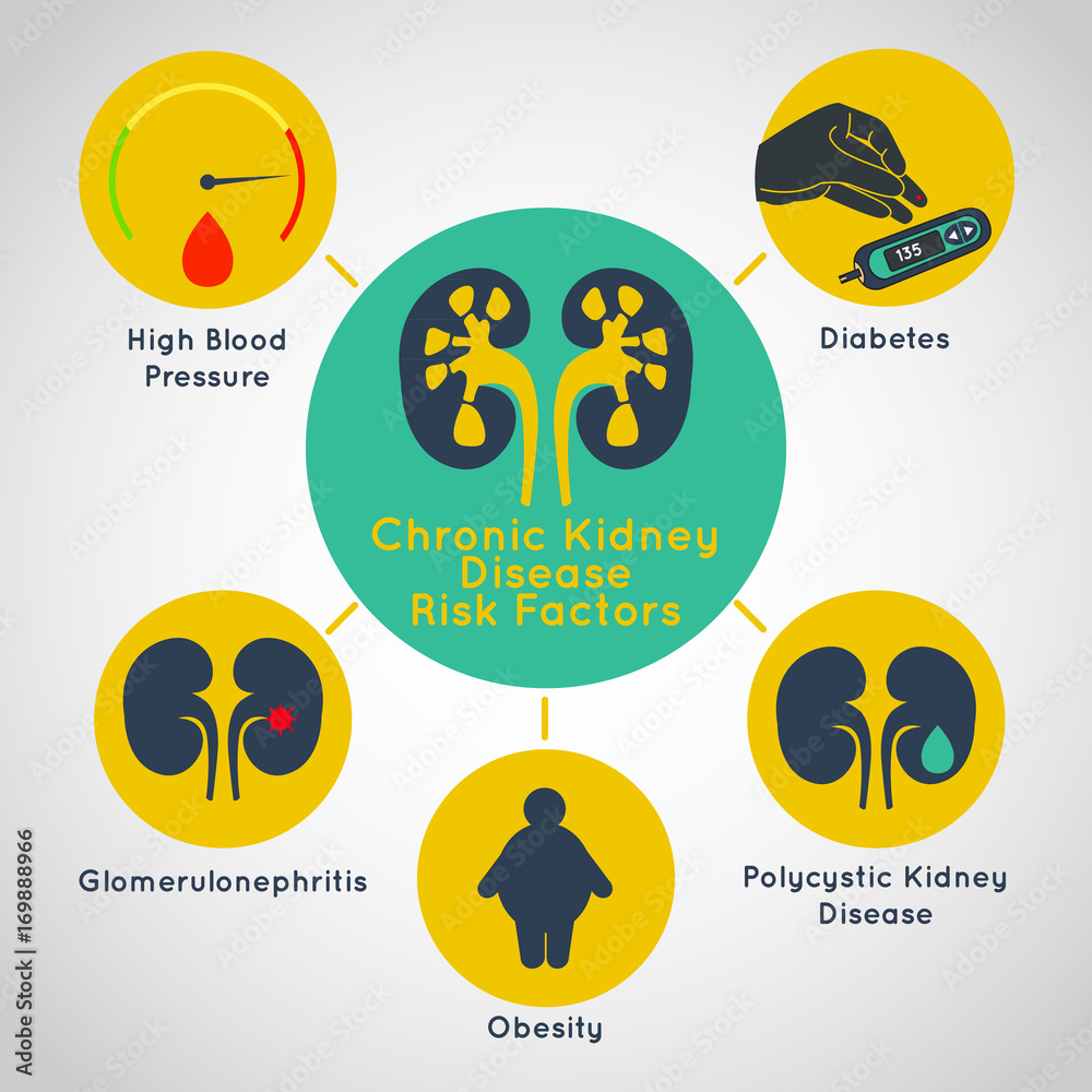 chronic kidney disease risk factors vector icon infographics Stock ...