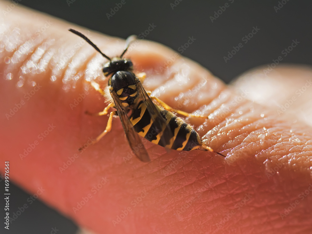 striped angry wasp stuck in pain sharp sting in the finger man Stock ...