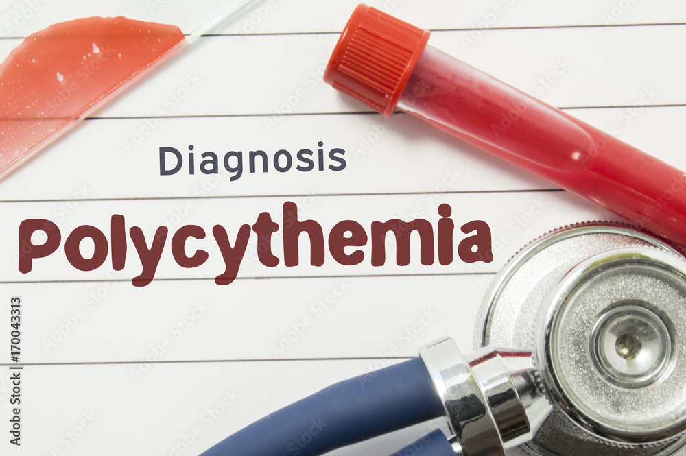 Diagnosis of Polycythemia. Medical book with text header hematological ...