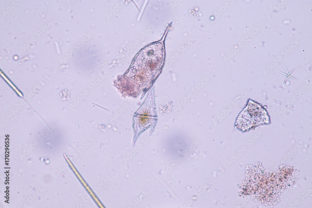 Ceratium/Dinoflagellate (Protozoa) under microscope. Stock Photo ...