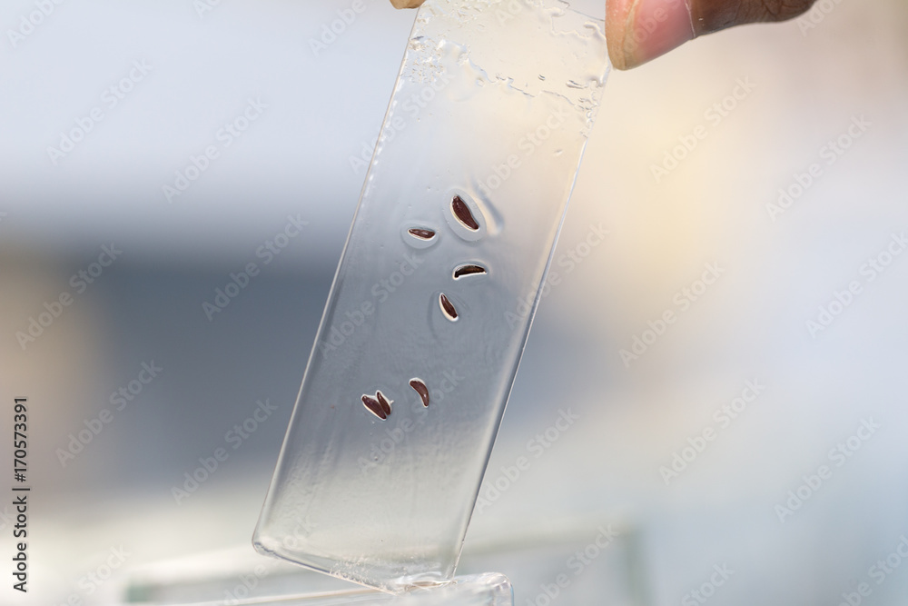 Leeches are segmented worms that belong to the phylum Annelida and ...