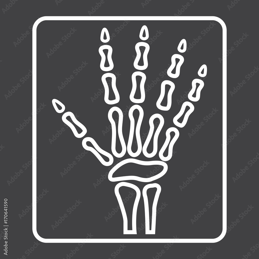 Hand X Ray Clipart