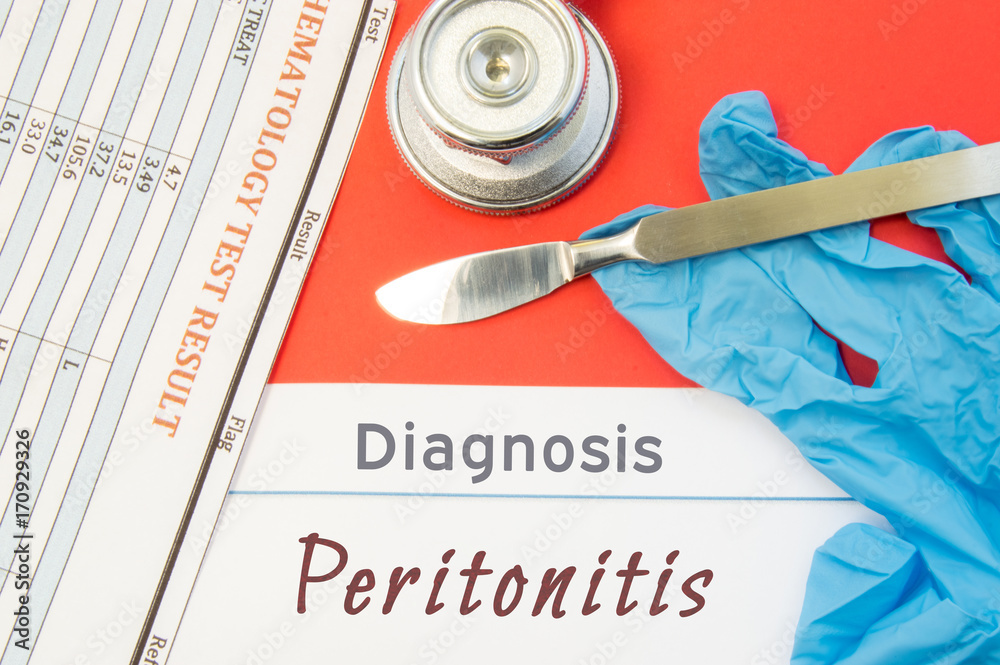 Surgical diagnosis of Peritonitis. Surgical medical instrument scalpel ...