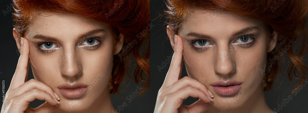 Woman face before and after cosmetic procedure. Plastic surgery concept ...