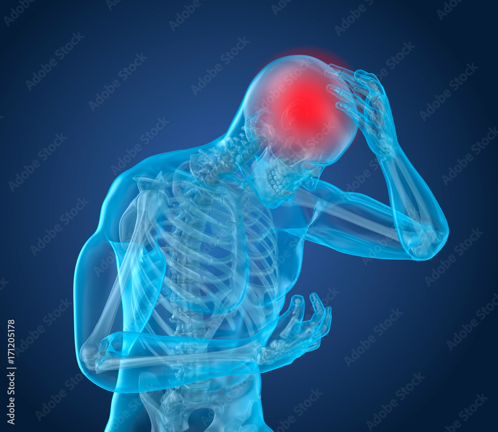Head pain Attack, man suffering from brain pain. 3D illustration Stock ...