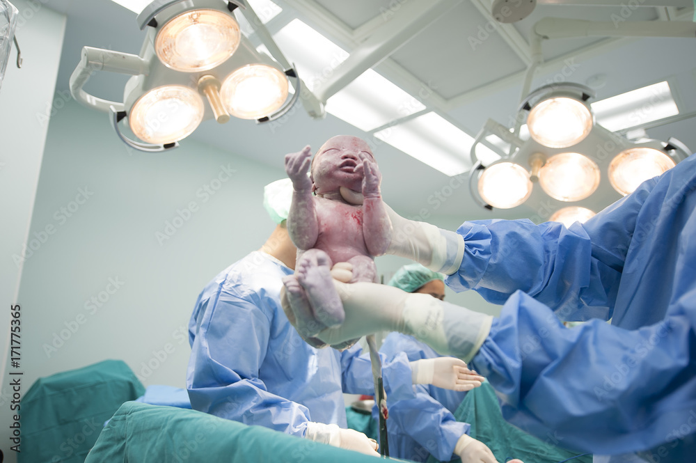 Foto de The medical team is performing caesarean sections do Stock ...