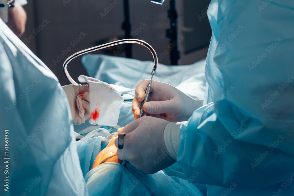 Surgeon and his assistant performing cosmetic surgery on nose in ...
