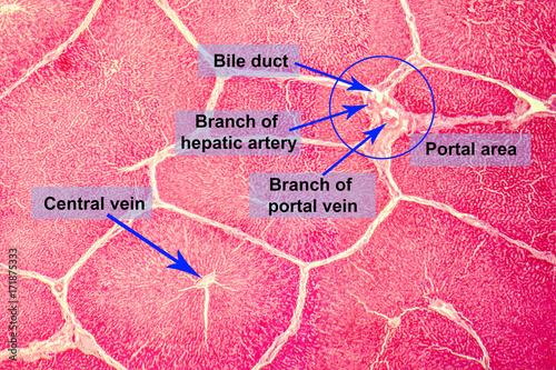 Hepatic Artery Branches