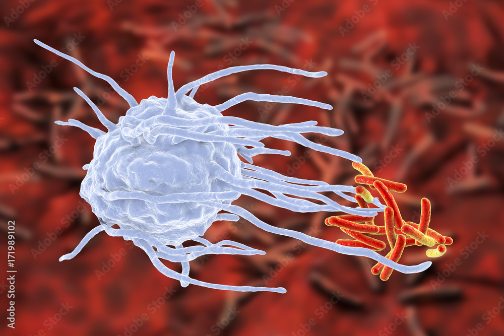 Macrophage engulfing tuberculosis bacteria Mycobacterium tuberculosis ...