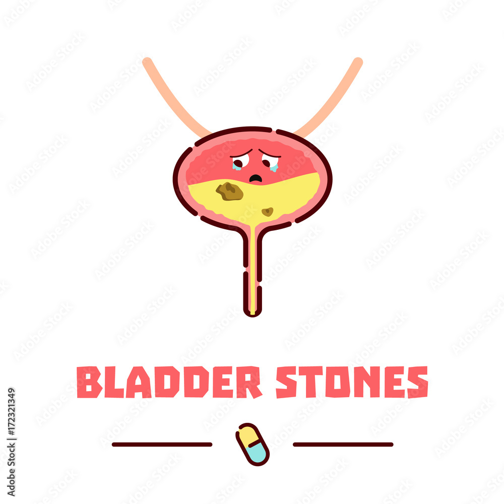 Bladder stone disease awareness poster. Cute sad unhealthy bladder icon ...