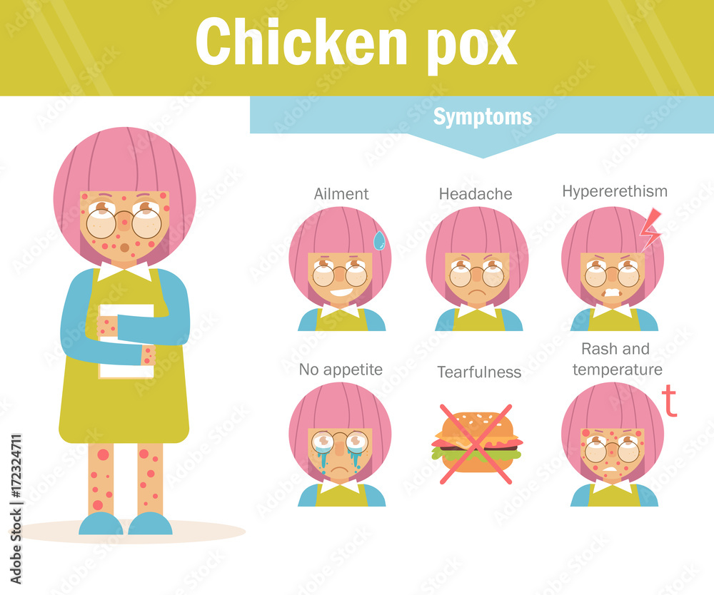 Chicken pox. Vector. Cartoon Stock Vector | Adobe Stock