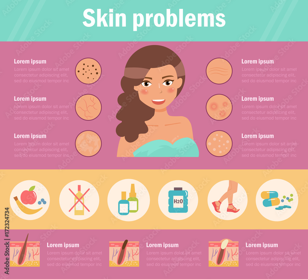 Types of skin problems. Vector. Cartoon Stock Vector | Adobe Stock