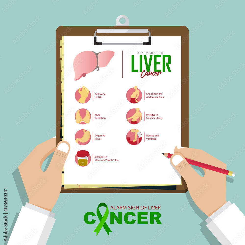 Infographic for alarming signs of liver cancer disease in flat design ...