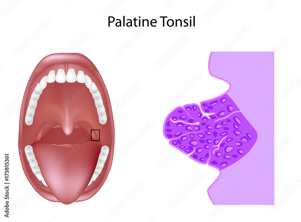 Anatomy of the palatine tonsil tissue in cross section, unlabeled ...