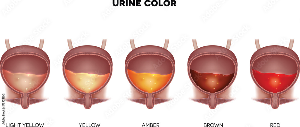 Photo Urine color chart from light yellow till red color, reineg ...