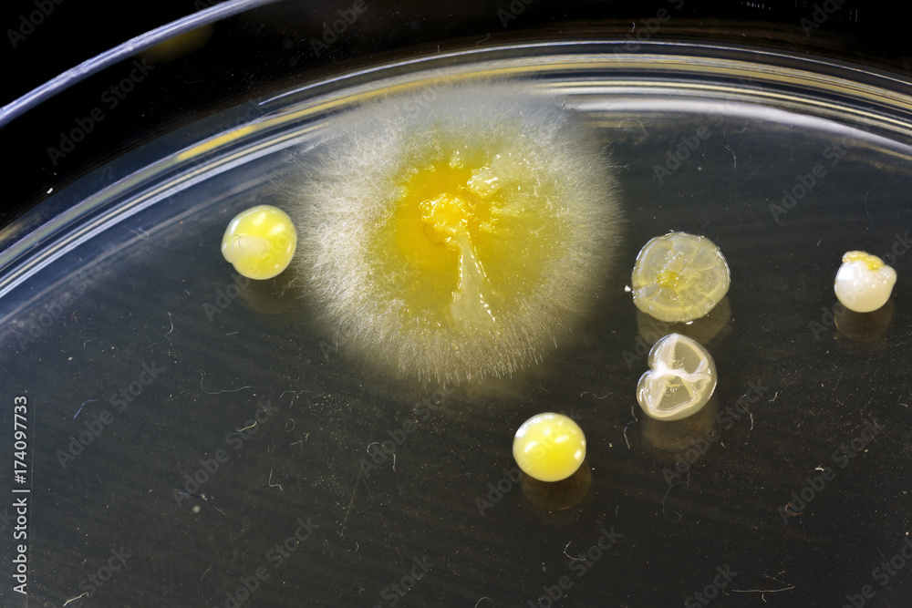 Different shaped colonies of bacteria, yeast and mold growing on agar ...