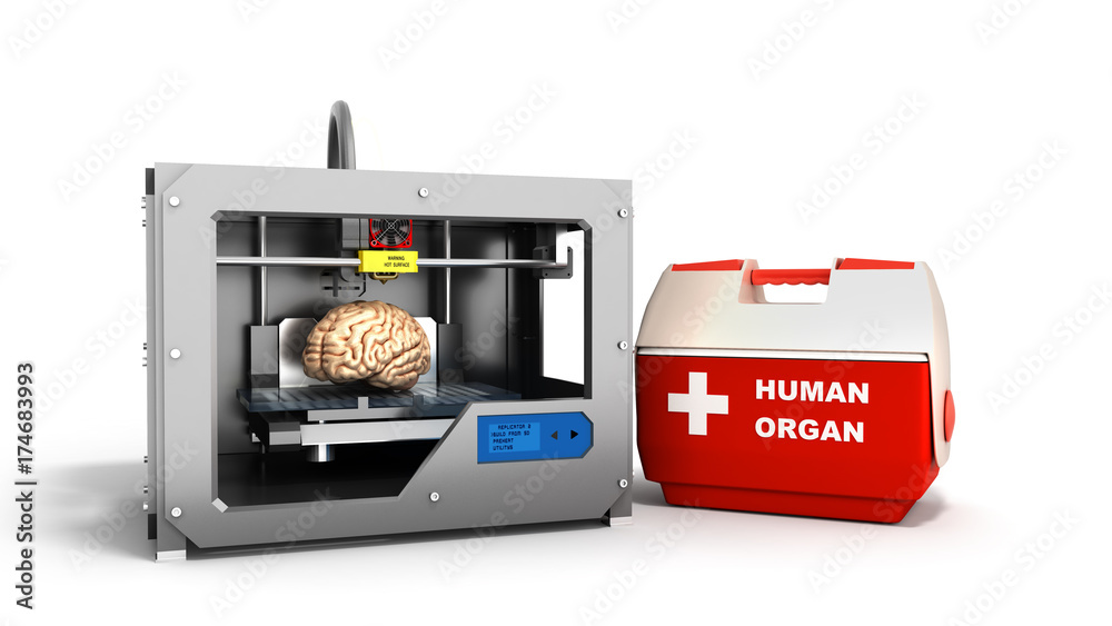 concept of transplantation process of creating human brain using 3D ...