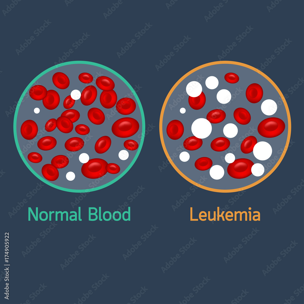Leukemia vector icon illustration Stock Vector | Adobe Stock