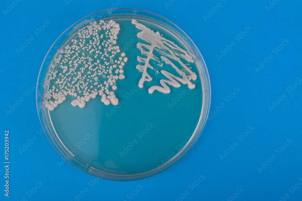 Petri dish with bacteria on blue background. Candida albicans bacteria ...