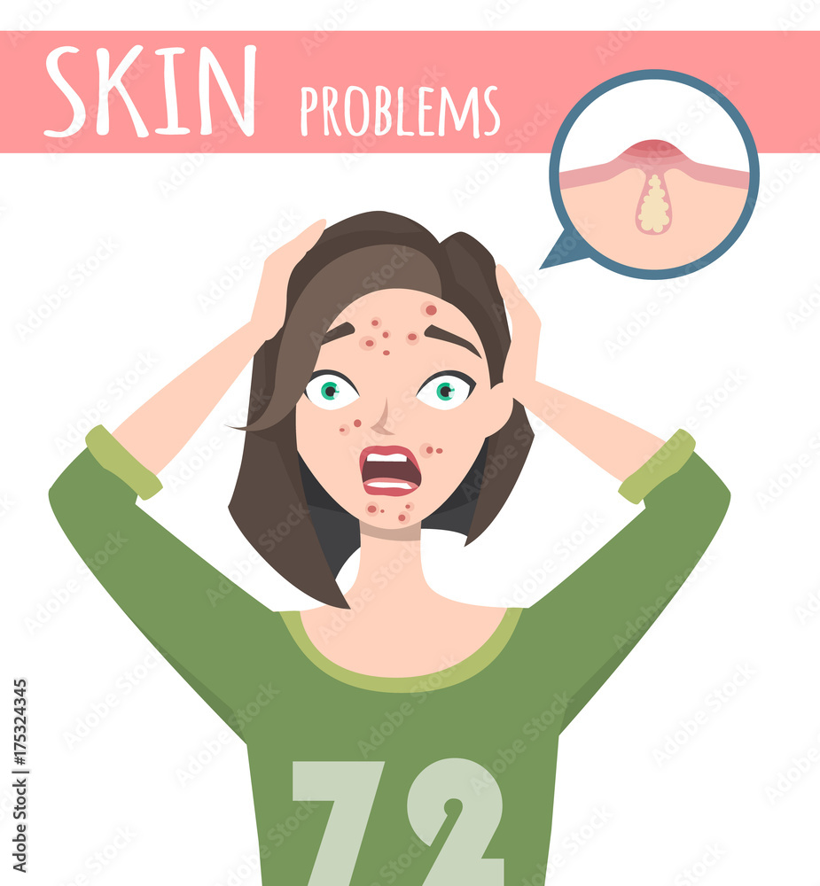 acne treatment before, facial cleansing foam, cartoon illustration ...