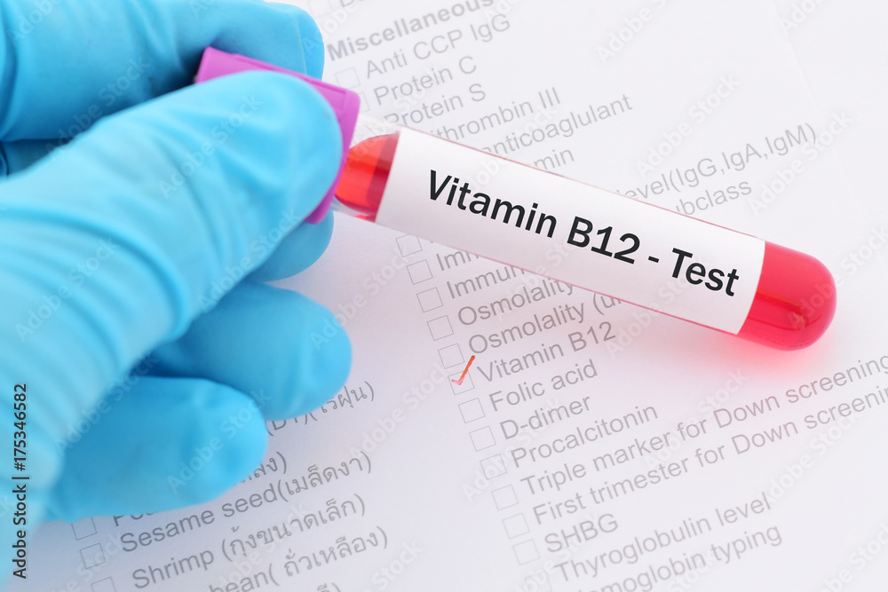 Foto de Blood sample with requisition form for vitamin B12 test do ...