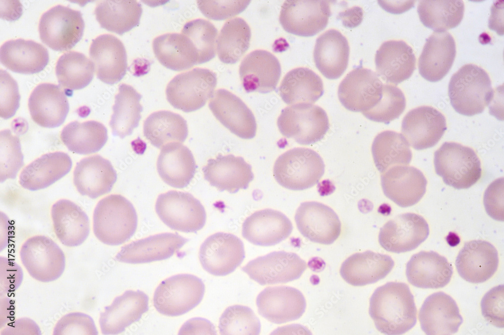 Red blood cells and platelet in blood smear Stock Photo | Adobe Stock