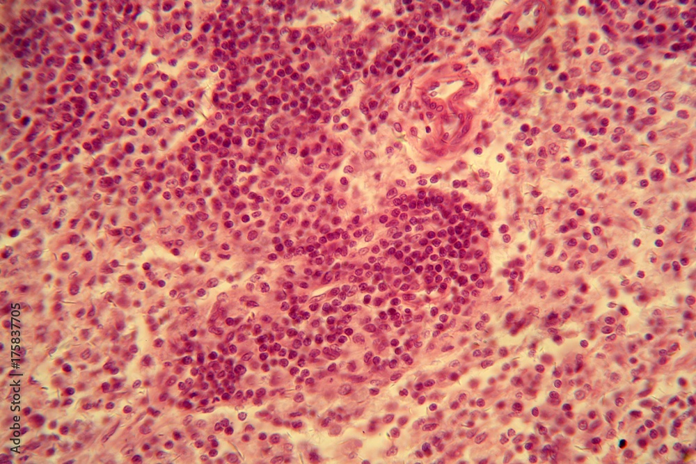 Lymph node cells under the microscope. Stock Photo | Adobe Stock