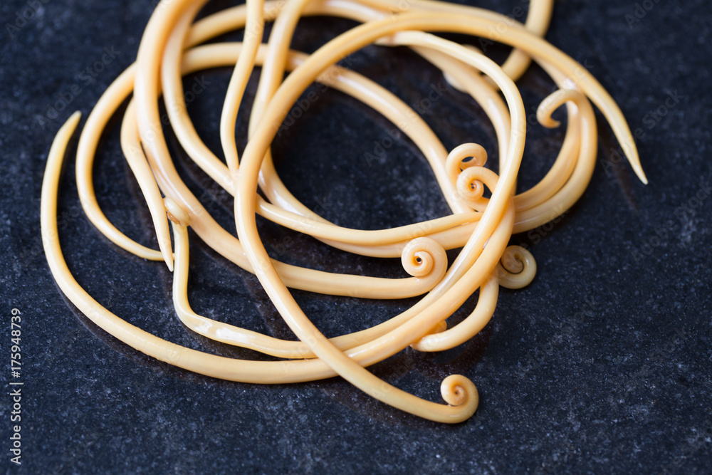 Ascariasis is a disease caused by the parasitic roundworm Ascaris lumbricoides for education in ...