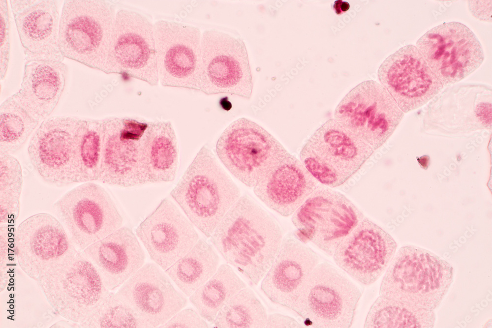 Mitosis cell in Root tip of Onion under a microscope. Stock Photo ...