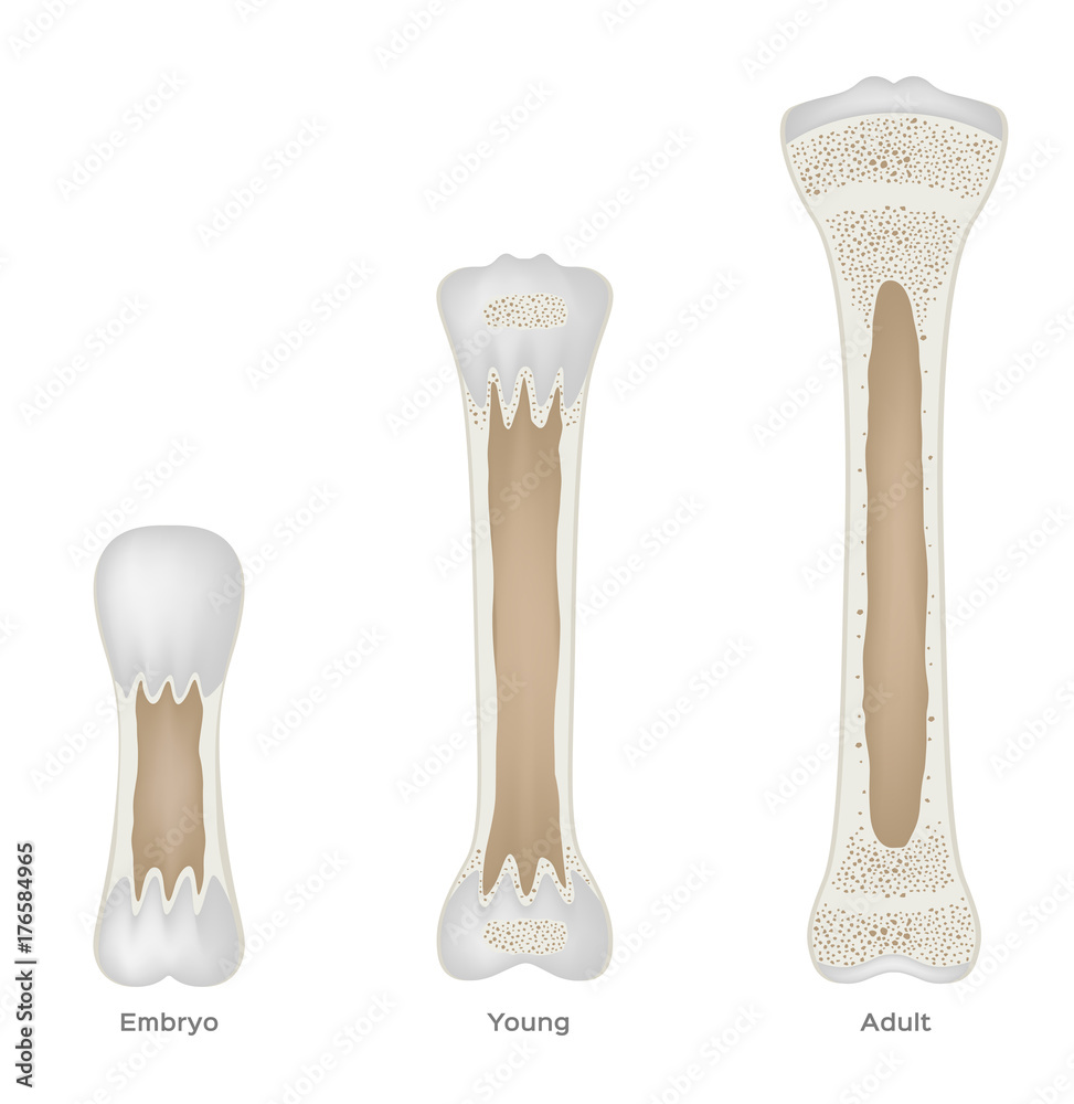 child bone growing to adult bone vector Stock Vector | Adobe Stock