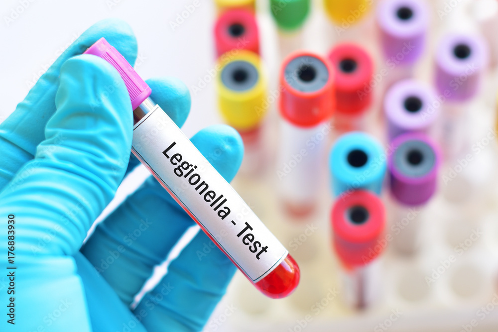 Blood sample for legionella (Legionnaires disease) test Stock Photo ...