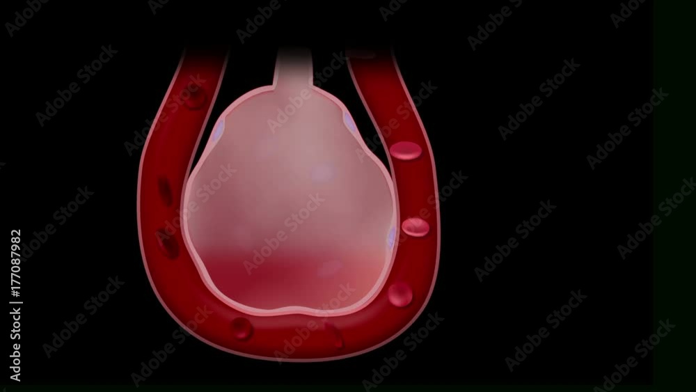 Gas exchange in alveoli of the lungs, animation vídeo de Stock | Adobe ...