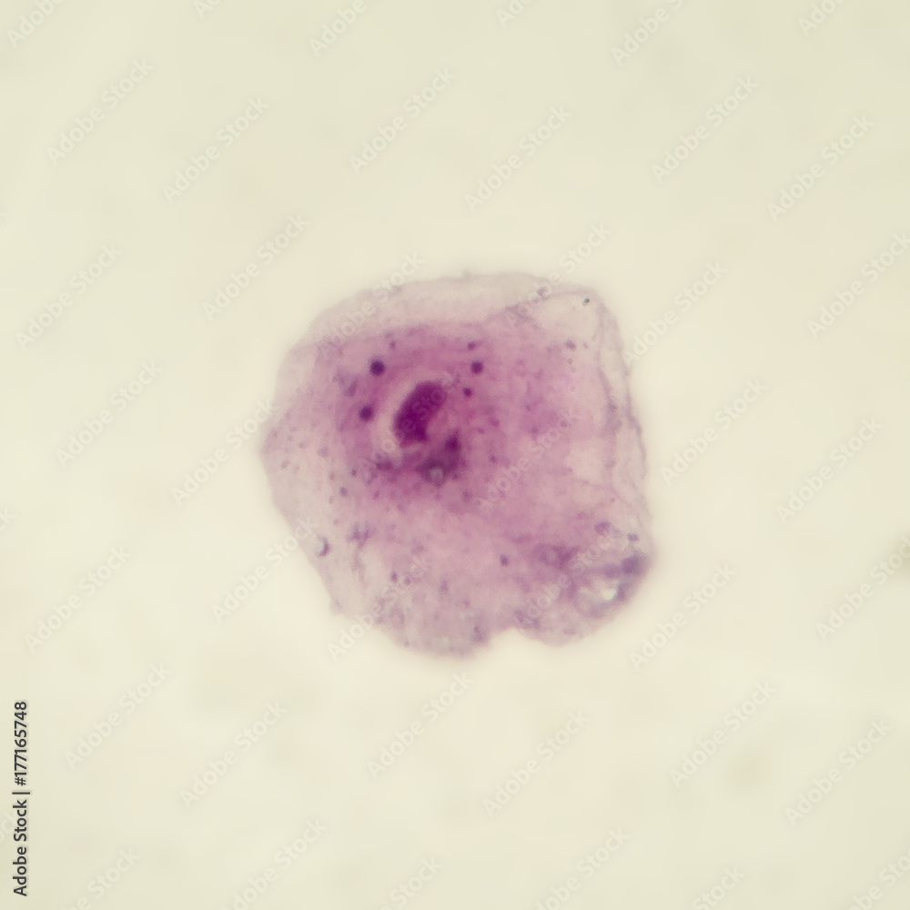 Human buccal smear under the microscope showing desquamated squamous ...