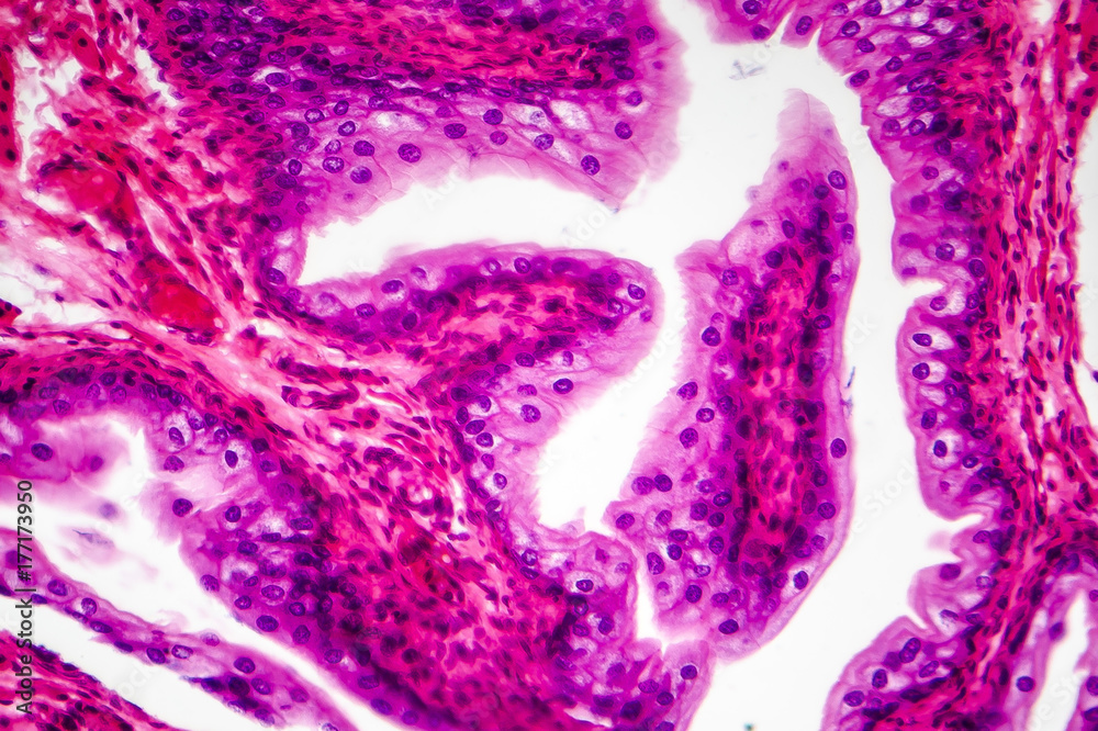 Transitional epithelium tissue of the urinary bladder under microscope ...