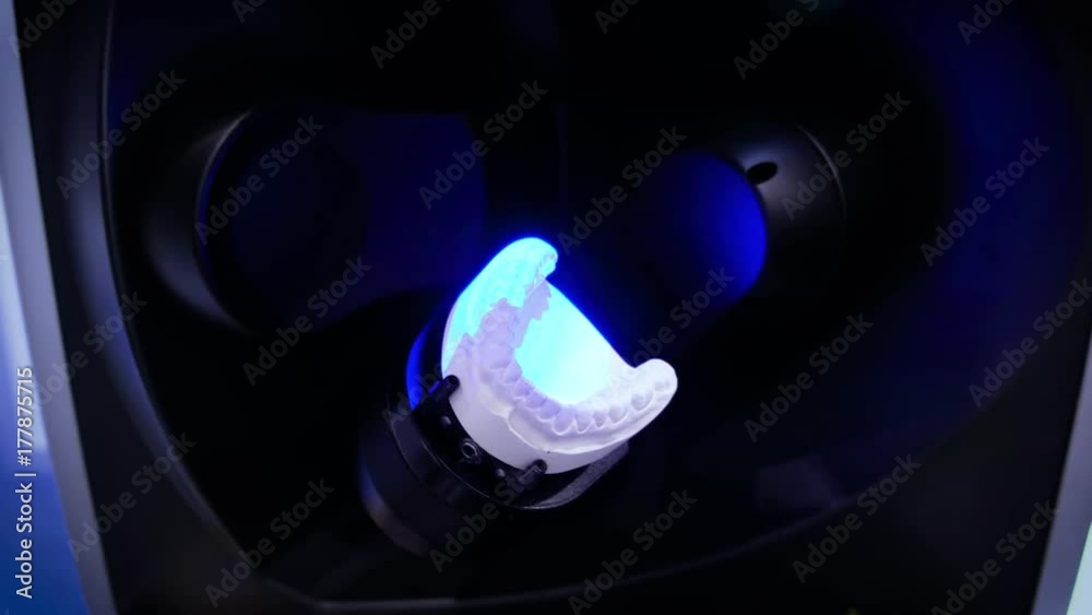 Dental prosthetic restoration. Denturist is making 3D model for ...