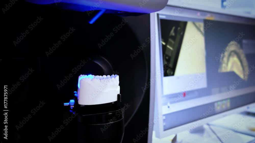 Dental prosthetic restoration. Denturist is making 3D model for ...