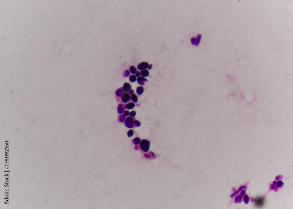 Candida Gram Stain