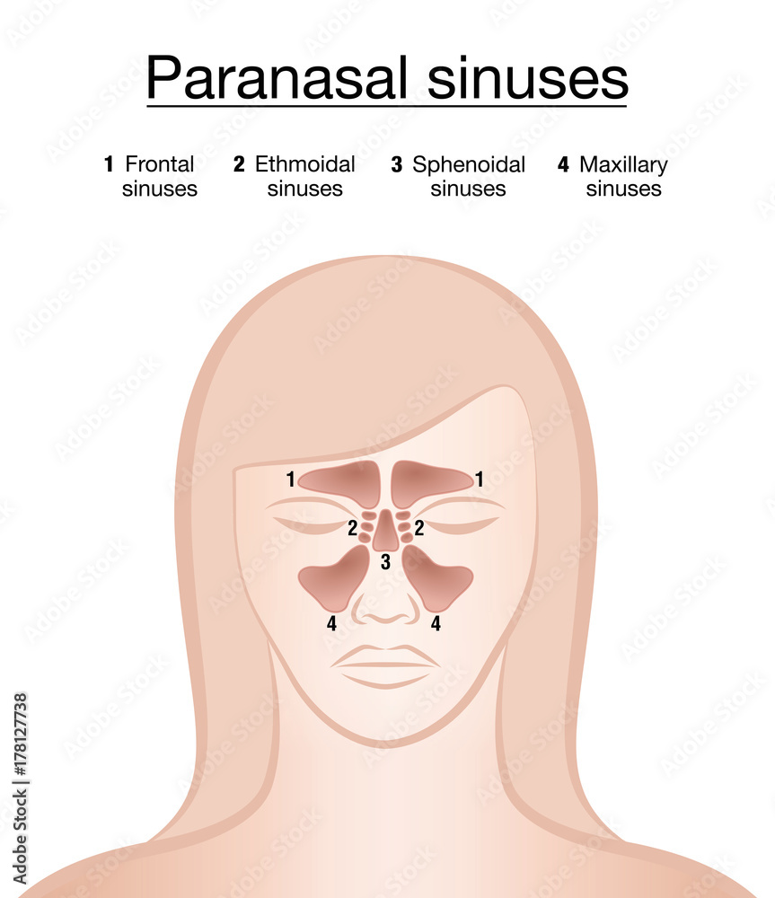 Paranasal sinuses - female face. Frontal, ethmoidal, sphenoidal and ...