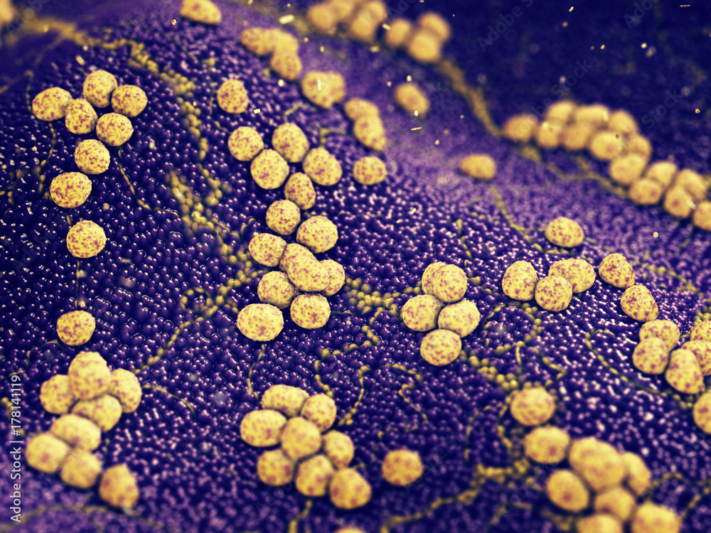 Colony of Staphylococcus aureus bacteria causing skin infection ...