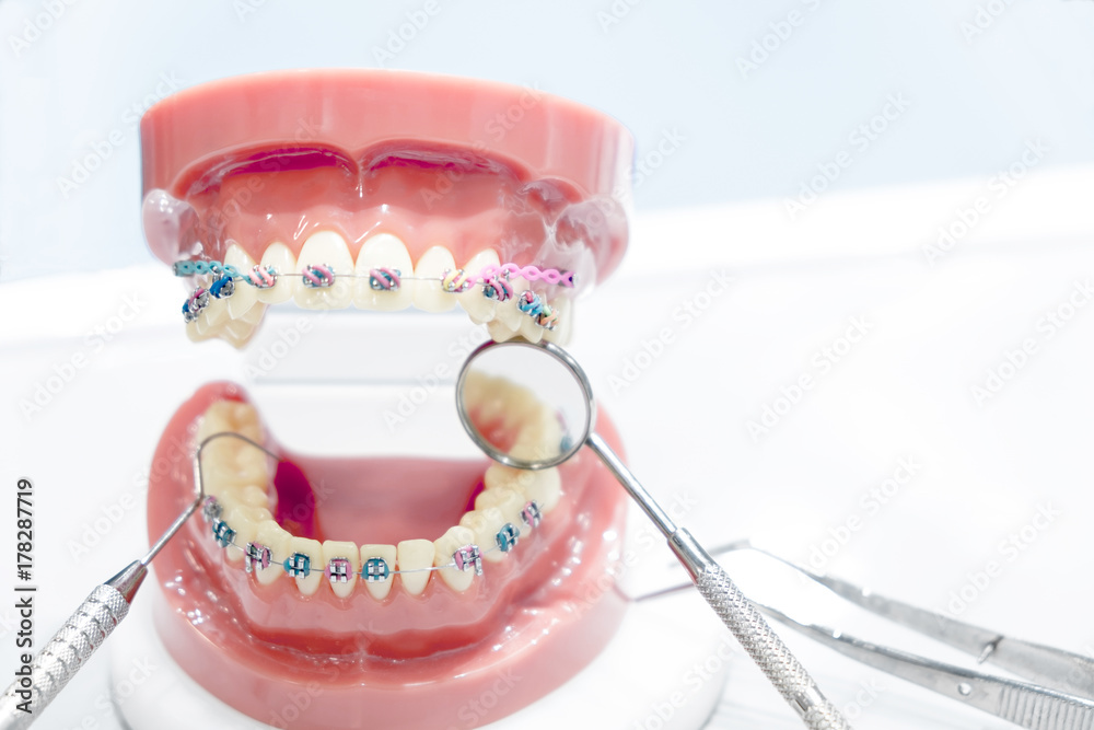 orthodontic model and dentist tool - demonstration teeth model of ...
