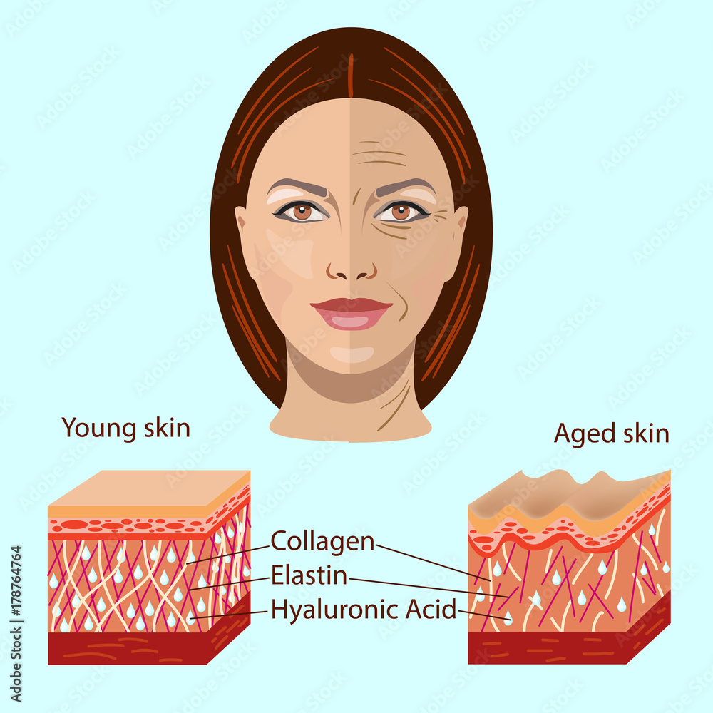 Vector face and two types of skin - aged and young for medical and ...