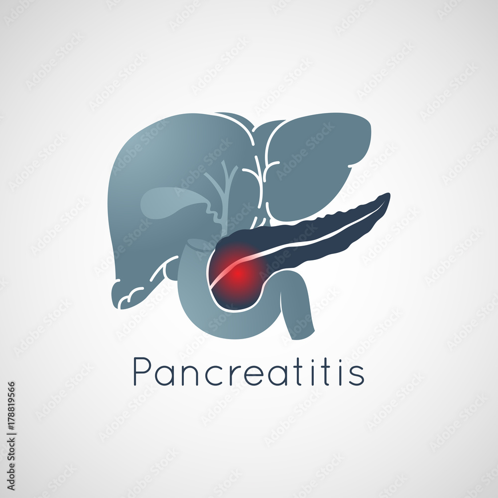 Pancreatitis vector logo icon illustration Stock Vector | Adobe Stock